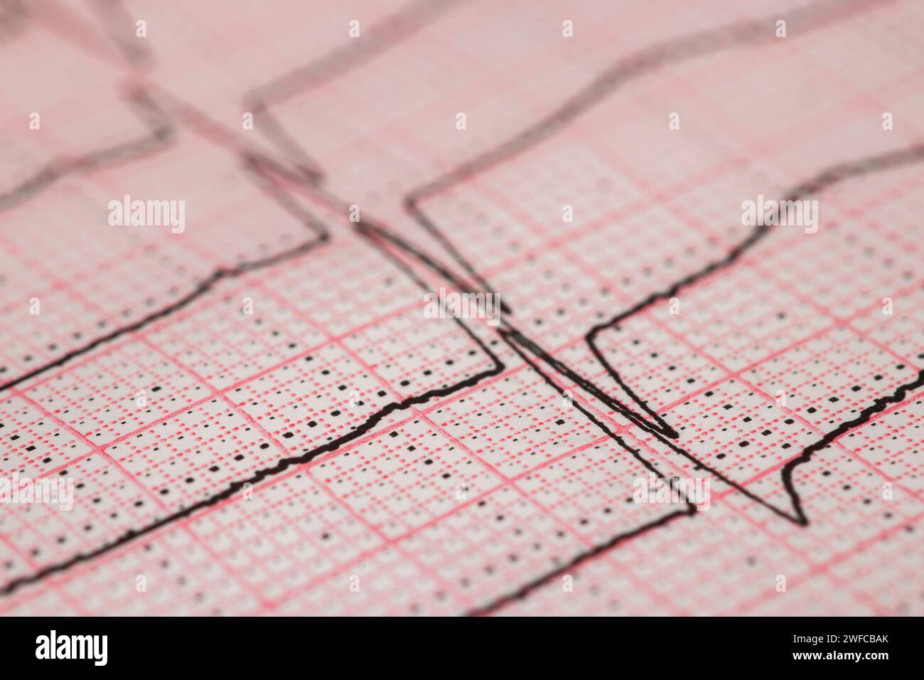 heart rhythm ekg note on paper Doctors use it to analyze heart disease ...