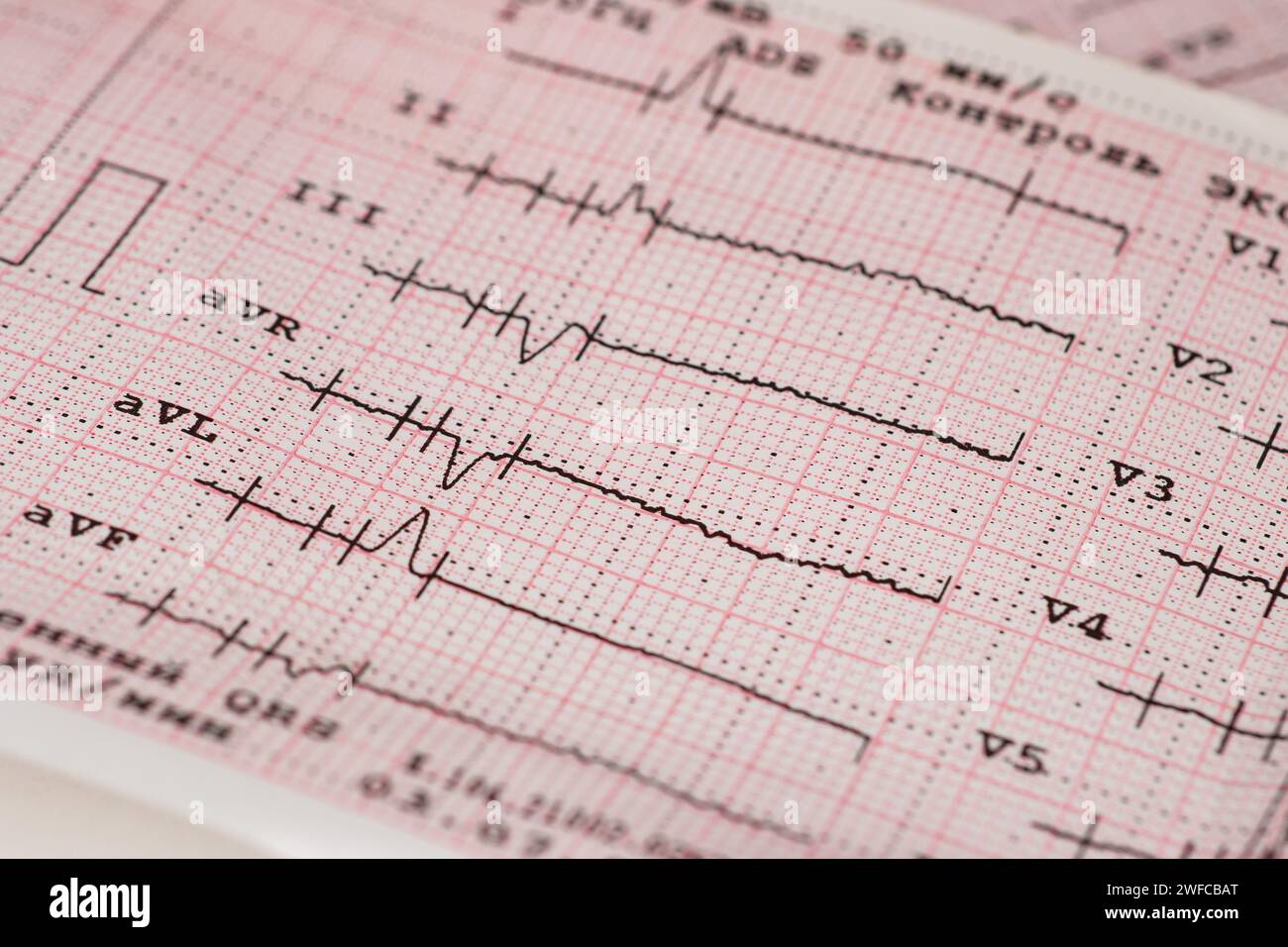 heart rhythm ekg note on paper Doctors use it to analyze heart disease ...