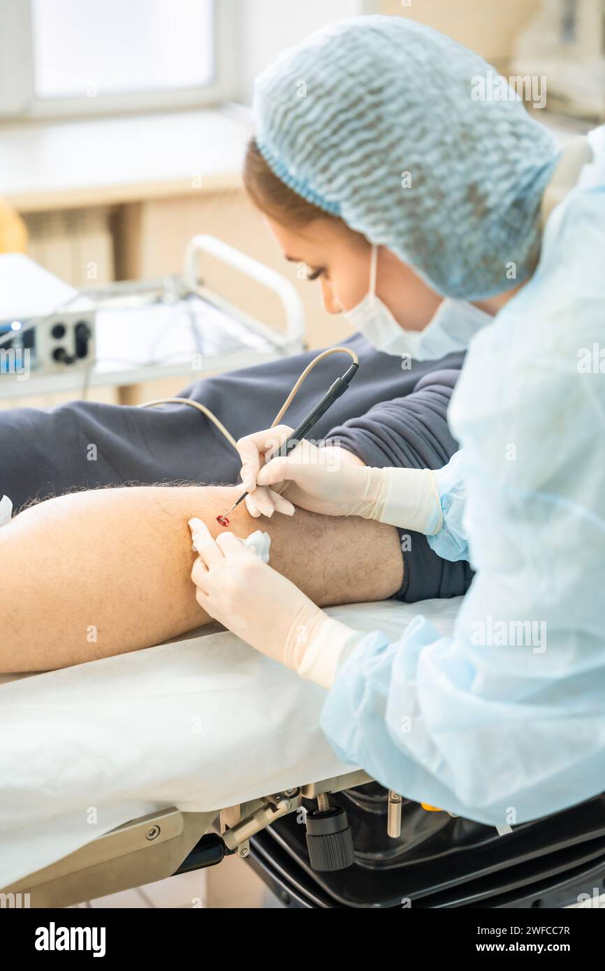 Dermatologist surgeon woman removes skin diseases with ...