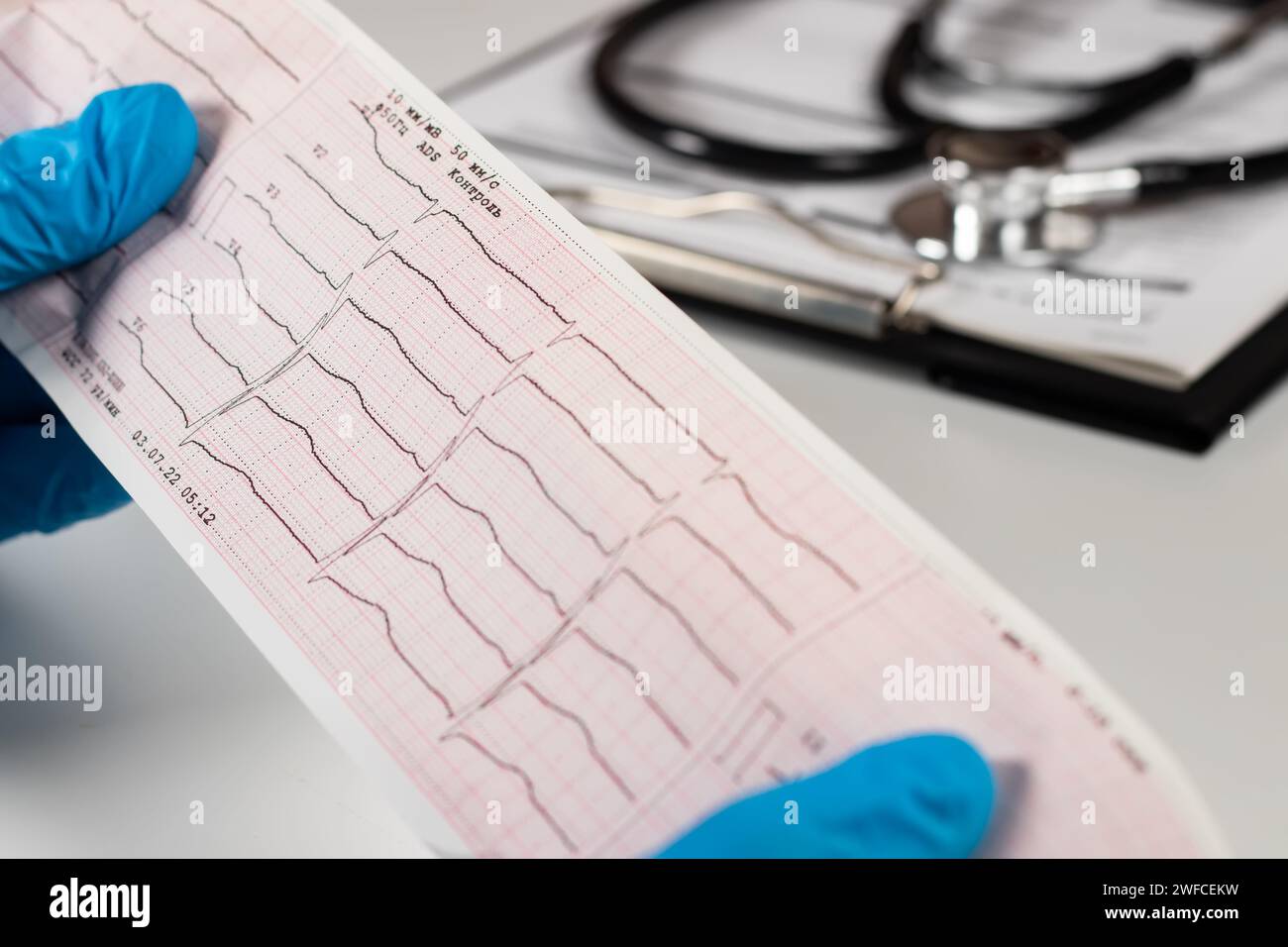 Doctor's hands hold result of the cardiogram next to patient sitting ...