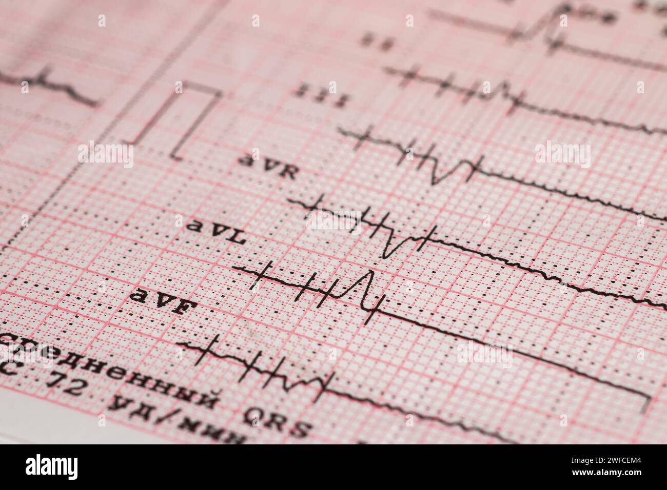 Close up of an electrocardiogram in paper form Stock Photo - Alamy