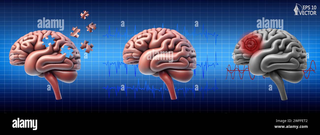 Realistic model of brain hi-res stock photography and images - Alamy