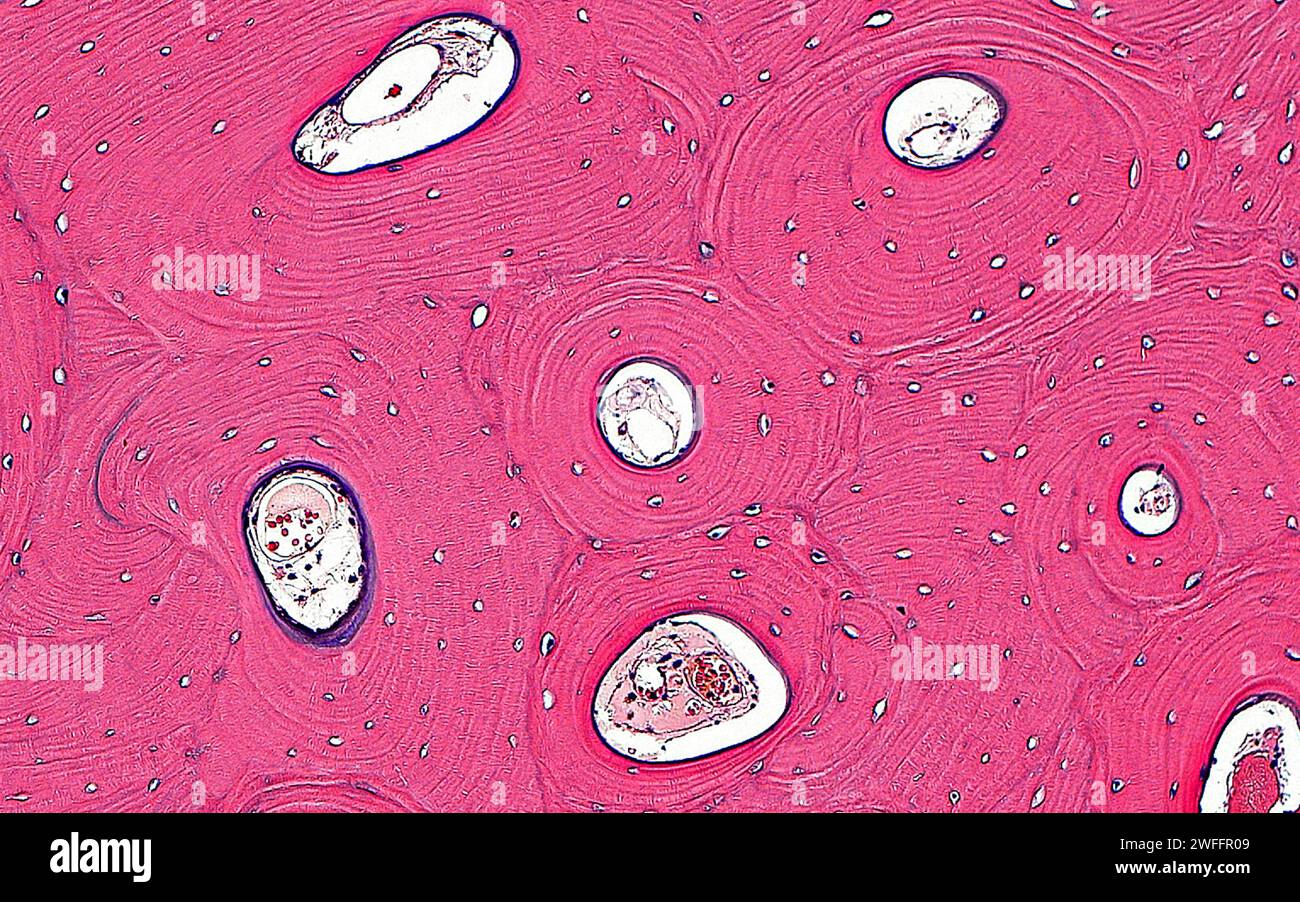 Lamellar bone, light micrograph Stock Photo - Alamy