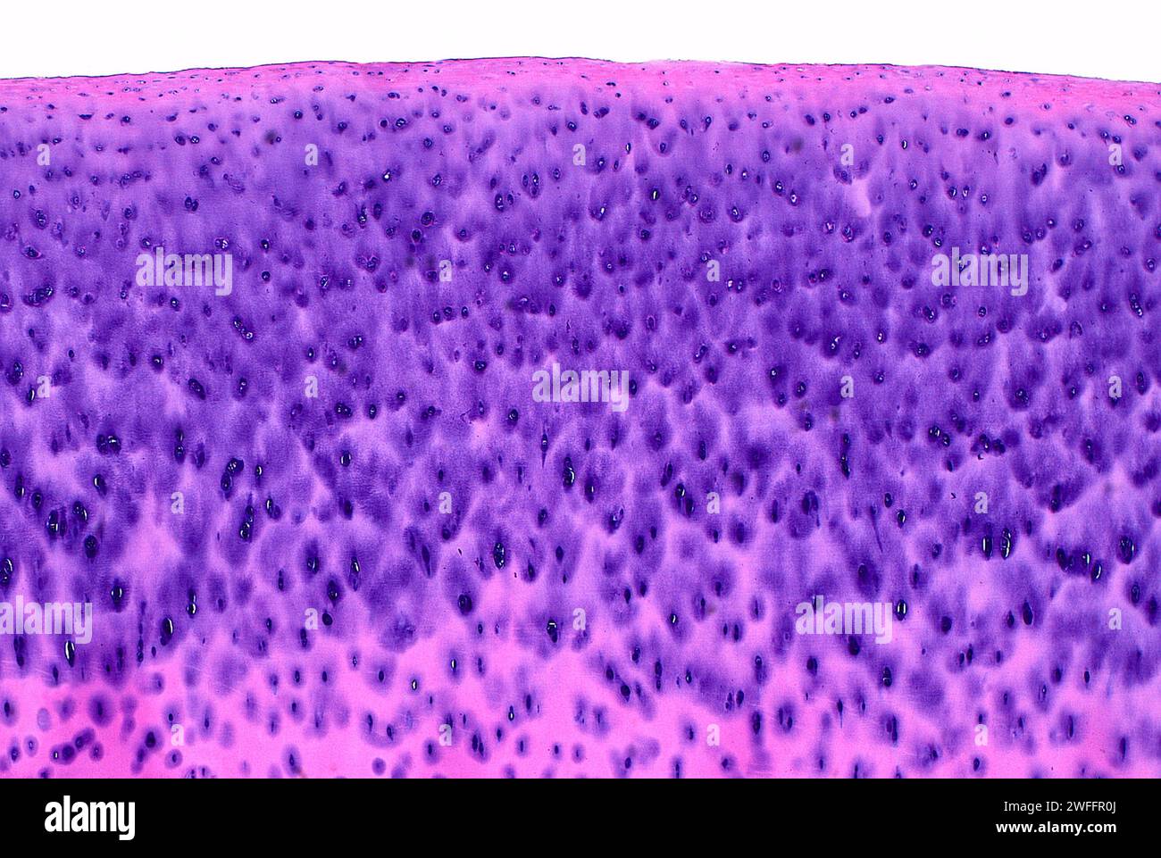 Articular cartilage, light micrograph Stock Photo - Alamy