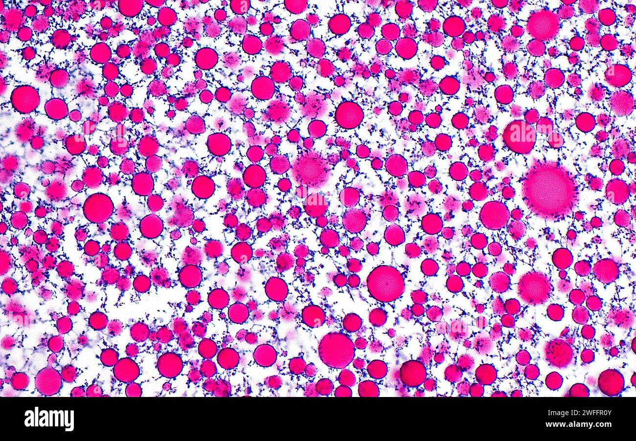 Colloid substance, light micrograph Stock Photo - Alamy