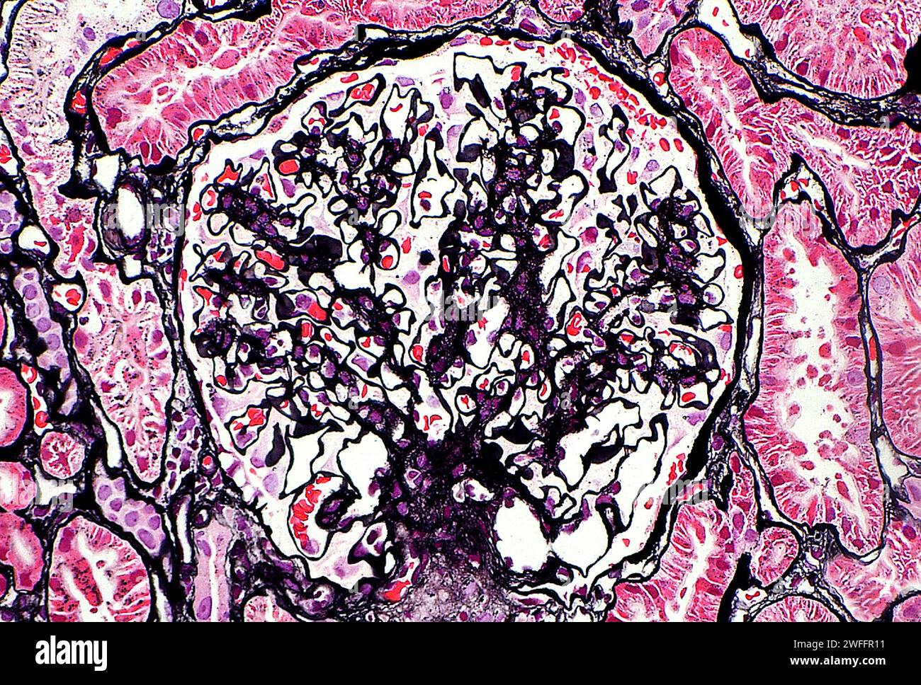 Kidney glomerulus, light micrograph Stock Photo - Alamy