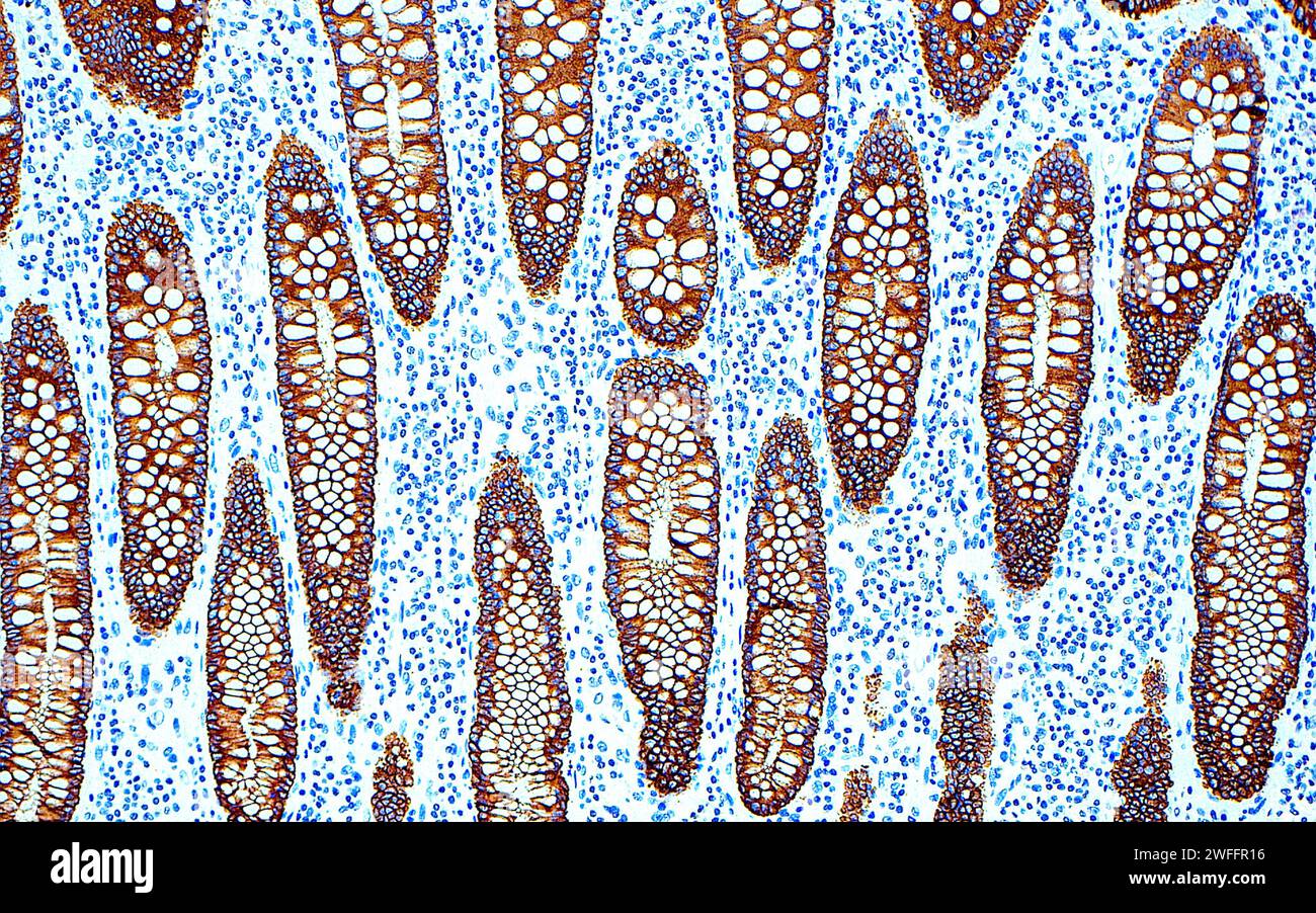 Colon crypts immunohistochemical stain, light micrograph Stock Photo ...