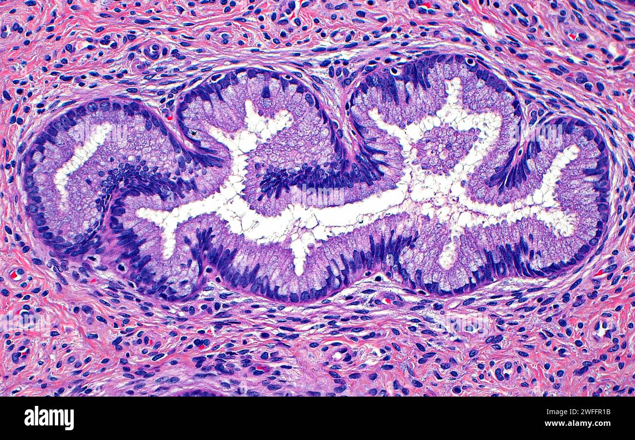 Endocervical gland, light micrograph Stock Photo - Alamy