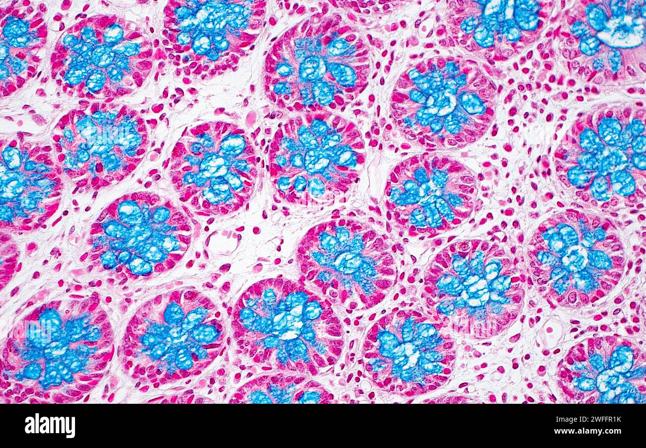 Colon crypts stained with Alcian blue, light micrograph Stock Photo - Alamy