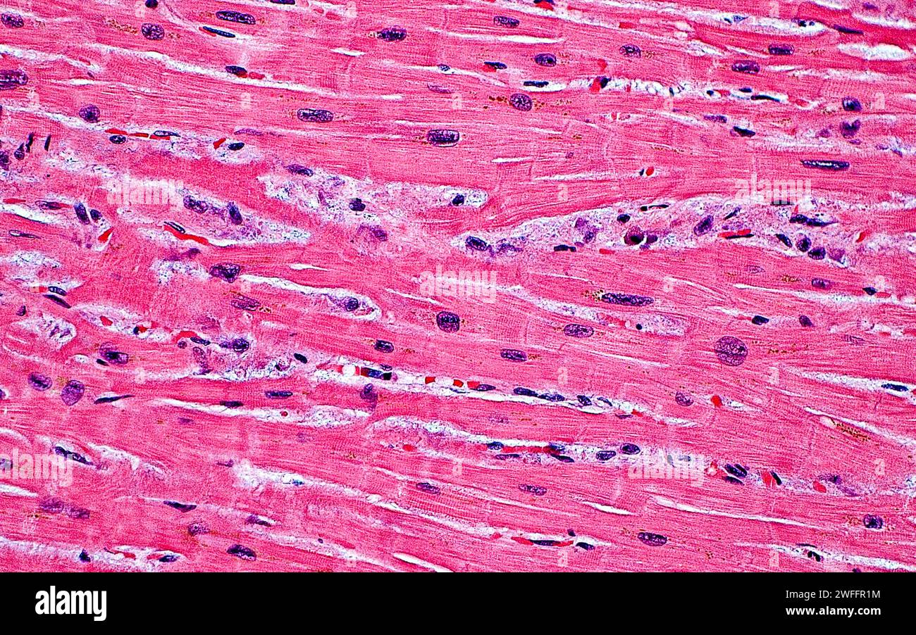 Heart muscle cells, light micrograph Stock Photo - Alamy