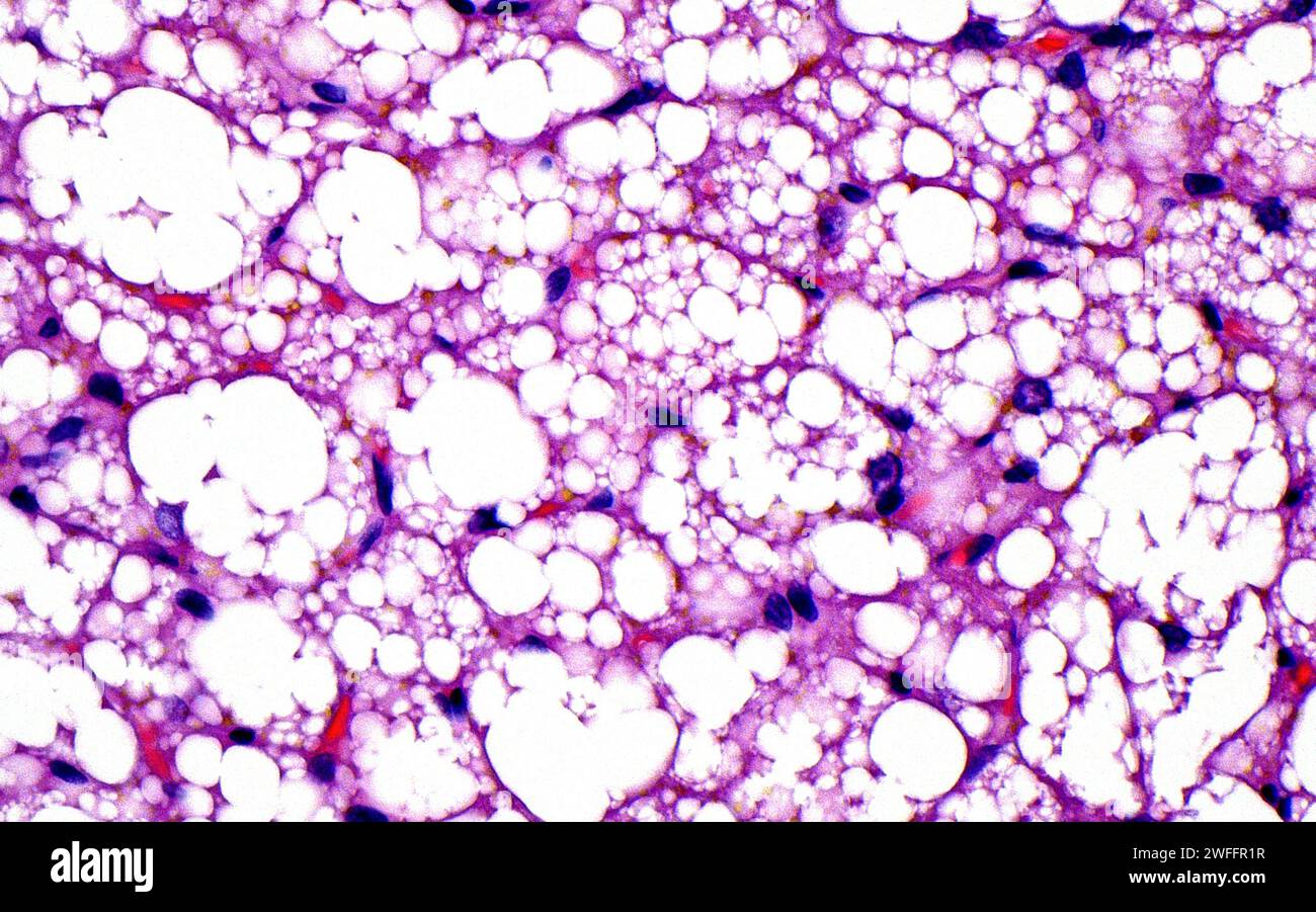 Brown fat cells, light micrograph Stock Photo - Alamy