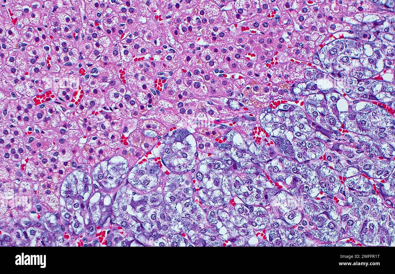 Adrenal cortex and medulla cells, light micrograph Stock Photo - Alamy