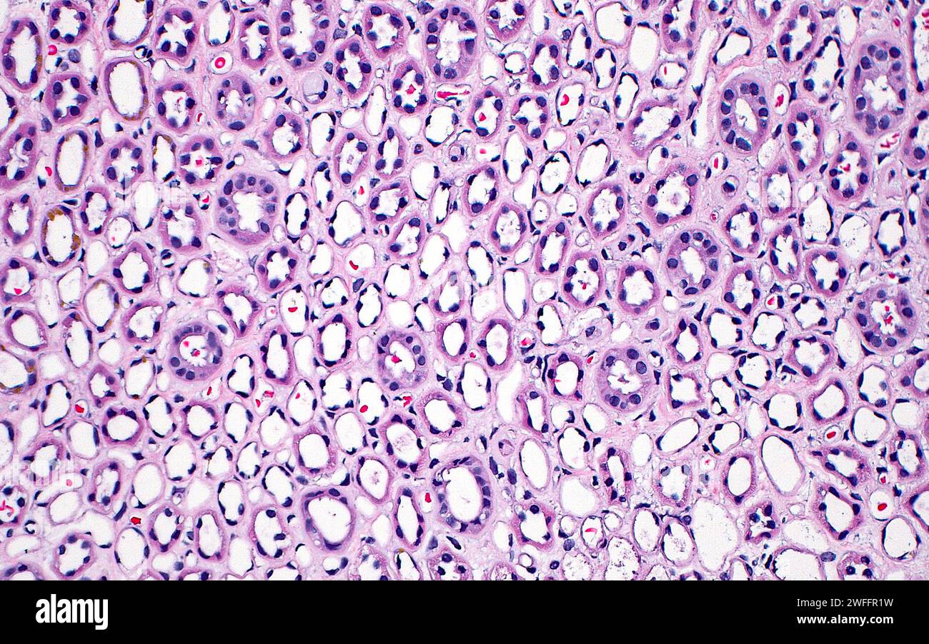 Kidney medulla, light micrograph Stock Photo - Alamy