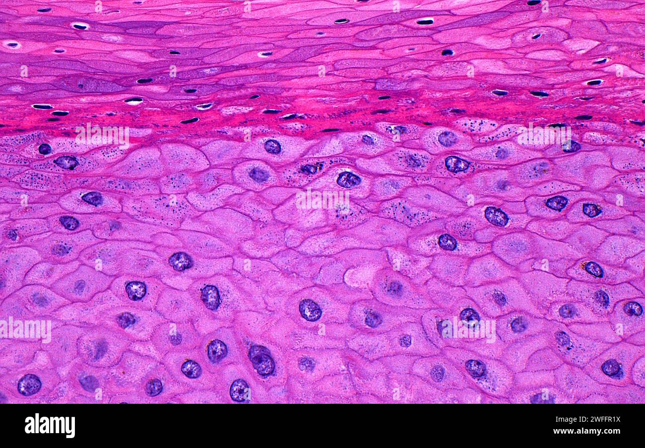 Skin epidermis squamous cells, light micrograph Stock Photo - Alamy