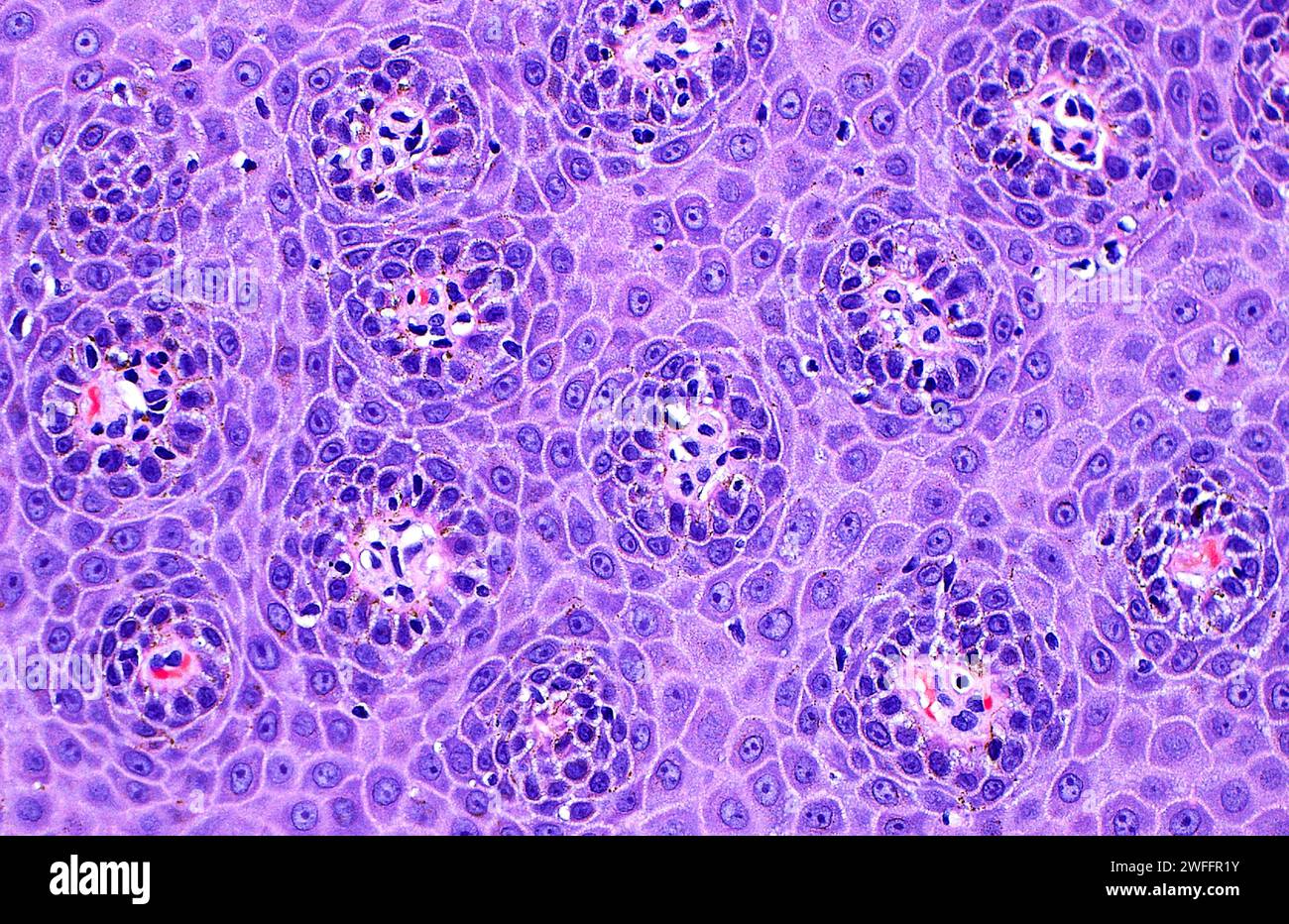 Skin epidermis papilla cross sections, light micrograph Stock Photo - Alamy