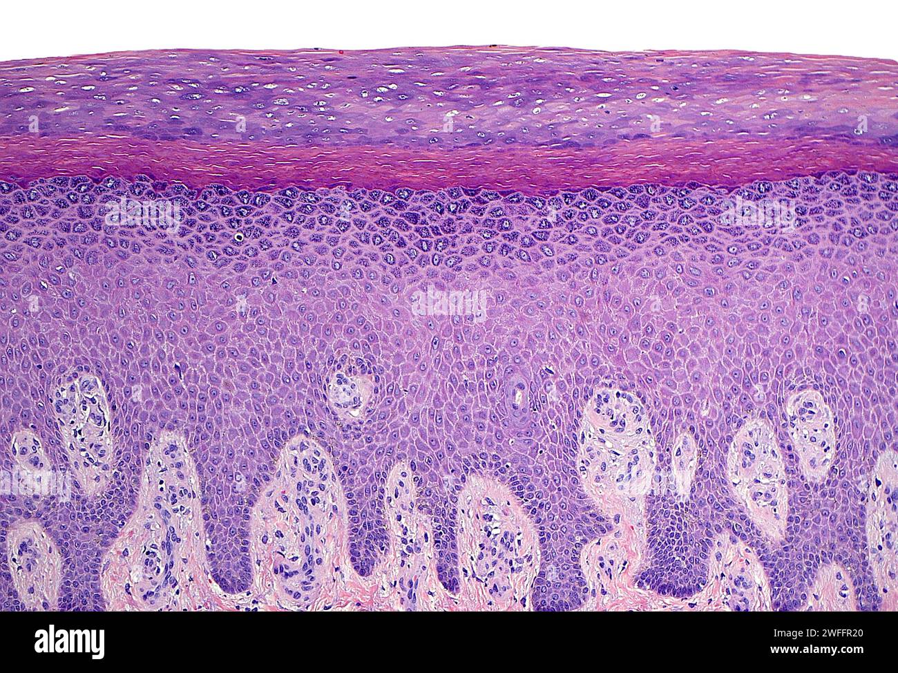 Skin epidermis, light micrograph Stock Photo - Alamy
