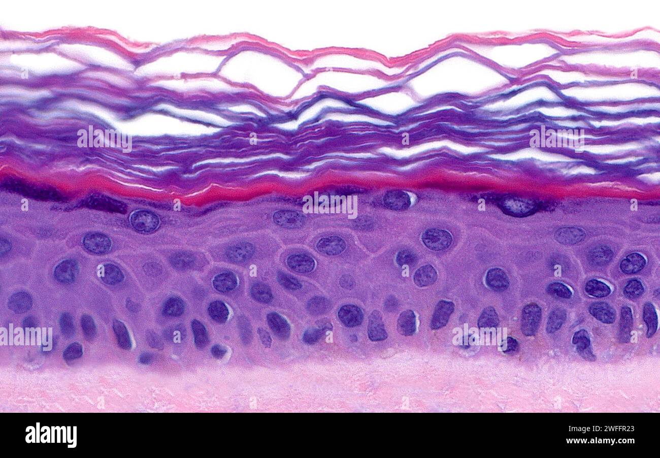 Skin epidermis, light micrograph Stock Photo - Alamy