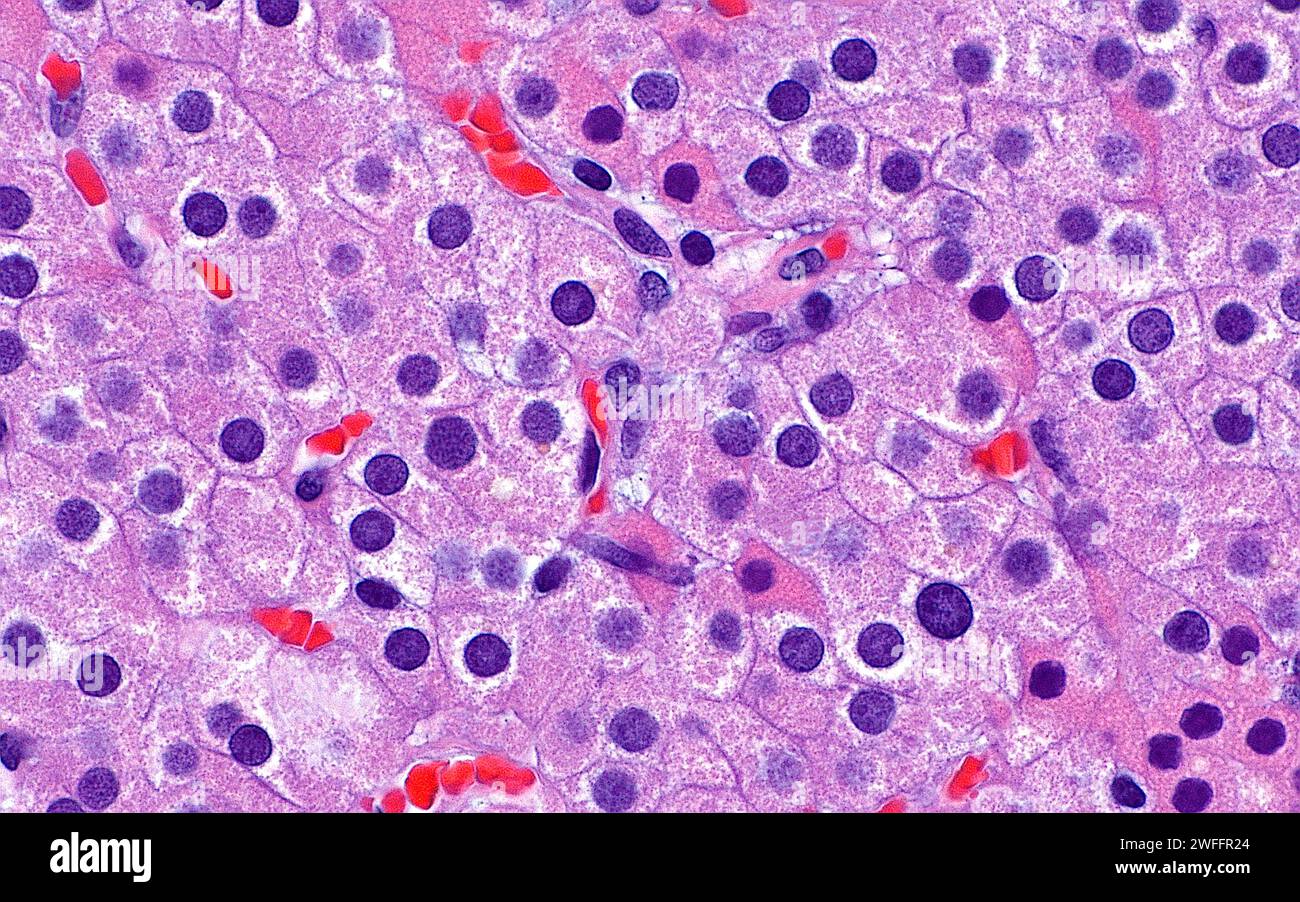 Parathyroid gland cells, light micrograph Stock Photo - Alamy