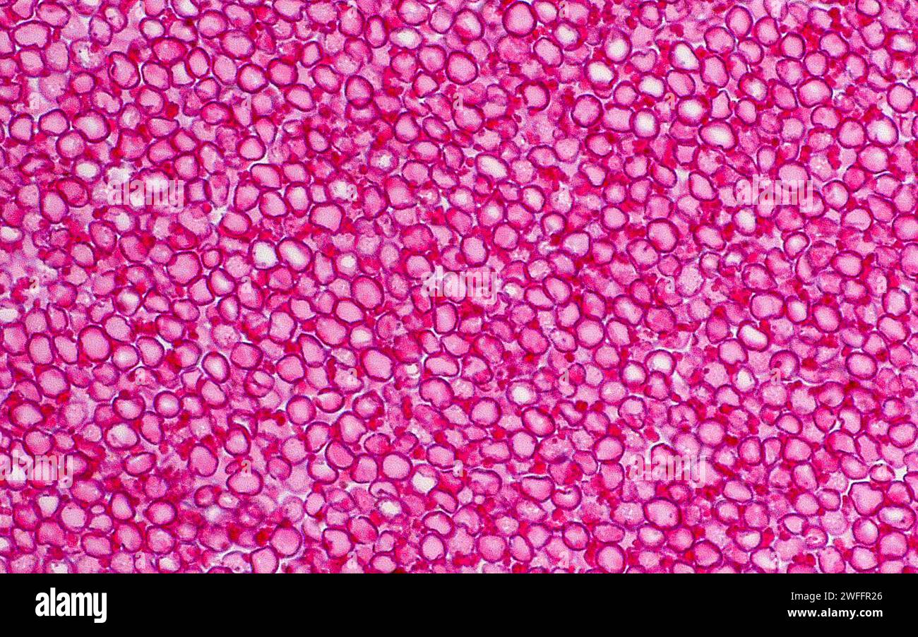 Red blood cells, light micrograph Stock Photo - Alamy