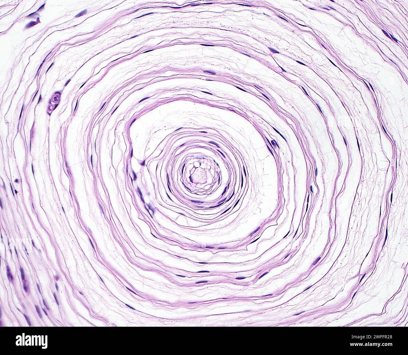 Pacinian corpuscle, light micrograph Stock Photo - Alamy