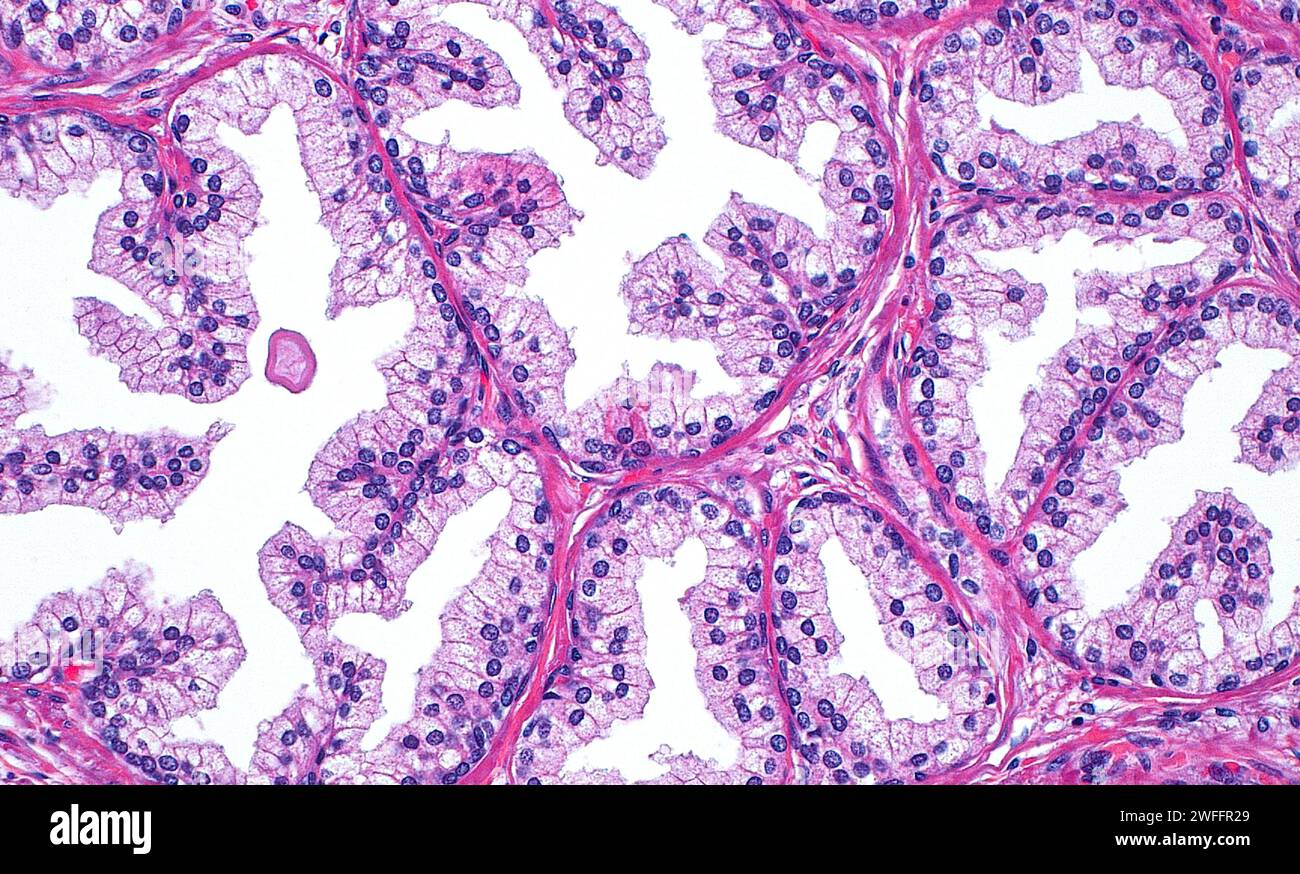 Prostate glands, light micrograph Stock Photo - Alamy