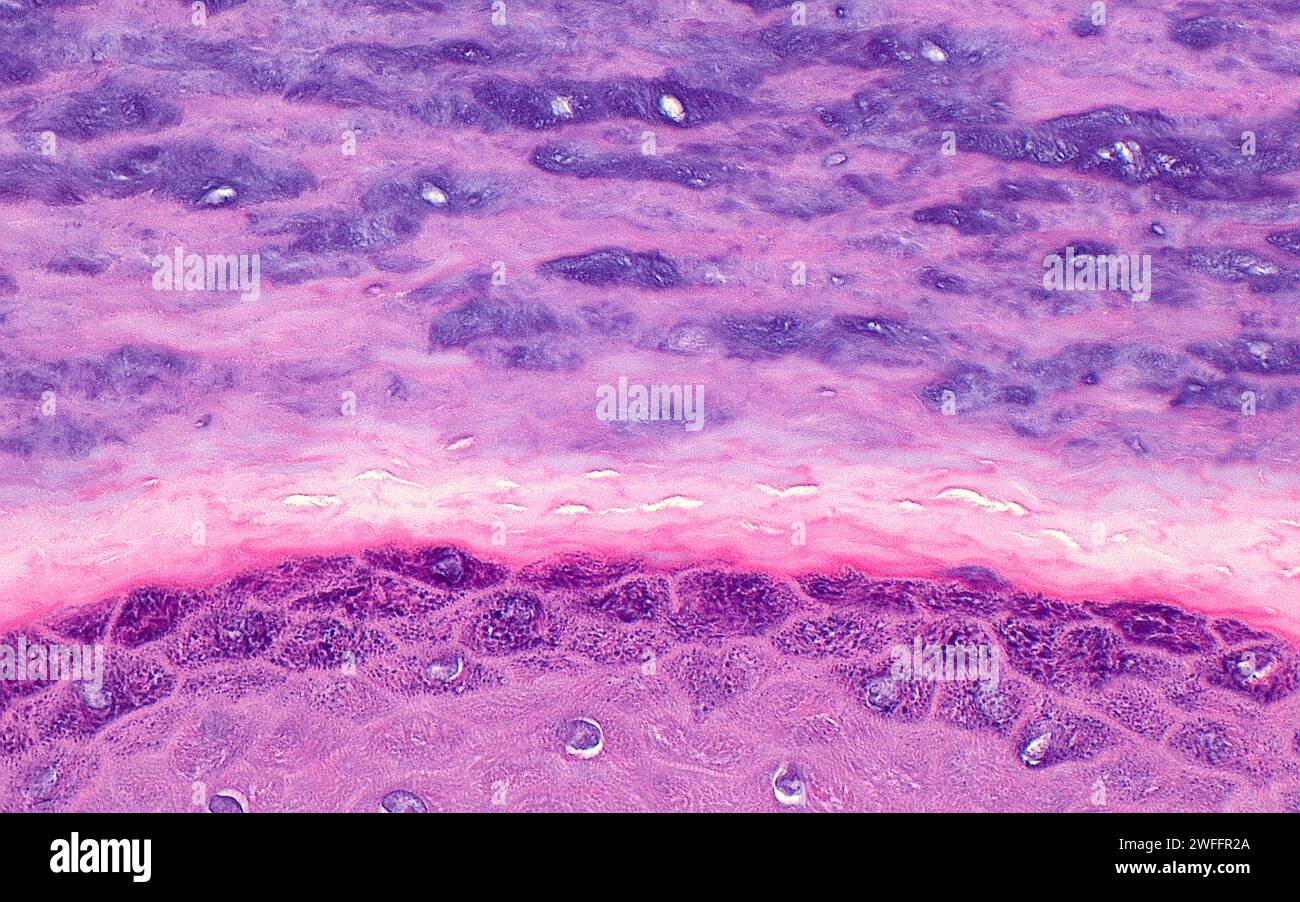 Skin epidermis with lucidum layer, light micrograph Stock Photo - Alamy