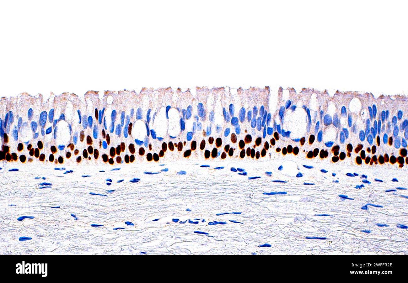 Respiratory epithelium immunostain, light micrograph Stock Photo - Alamy