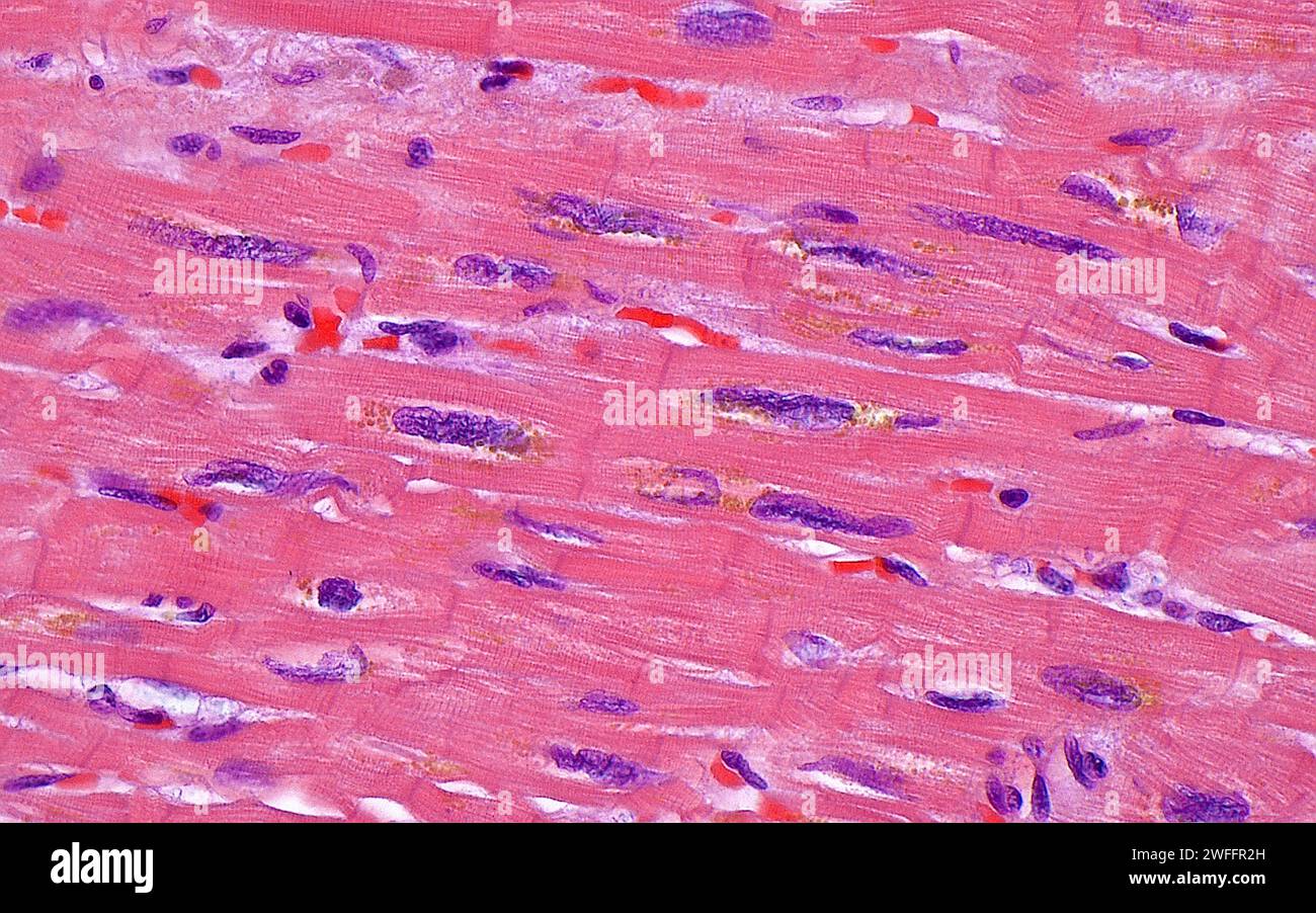 Heart muscle cells, light micrograph Stock Photo - Alamy