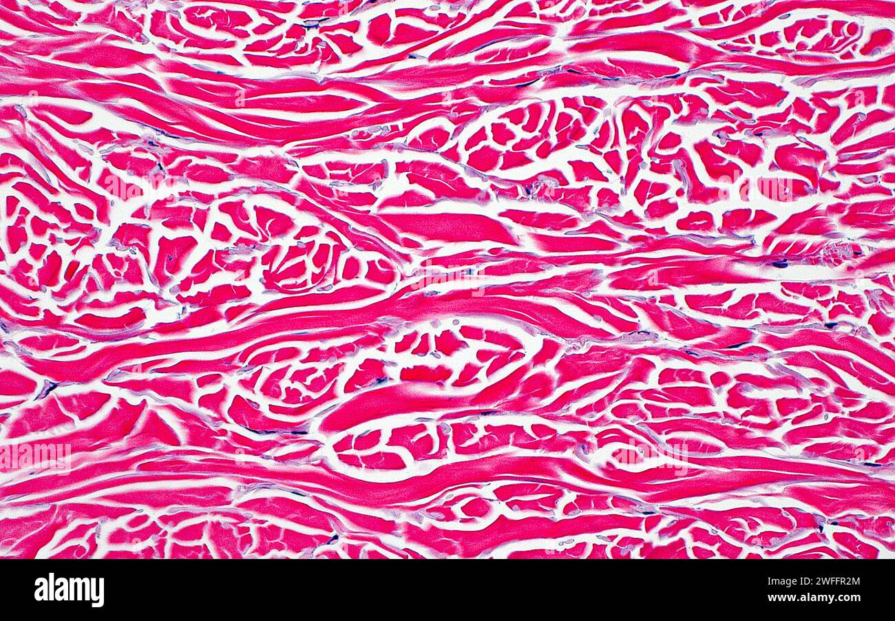 Skin dermis, light micrograph Stock Photo - Alamy