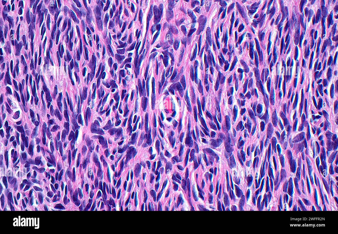 Ovary stroma, light micrograph Stock Photo - Alamy