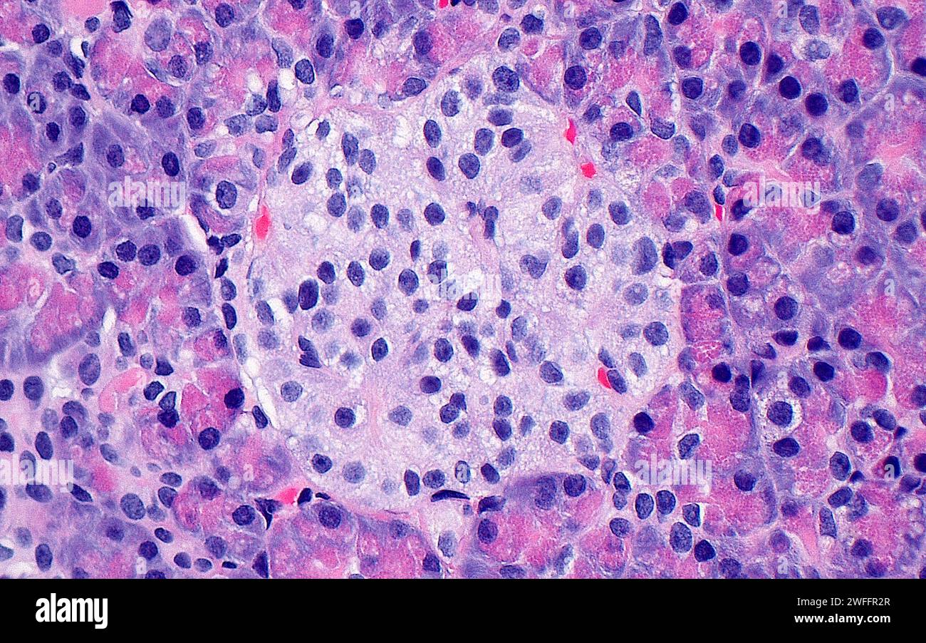 Pancreas Islet, light micrograph Stock Photo - Alamy