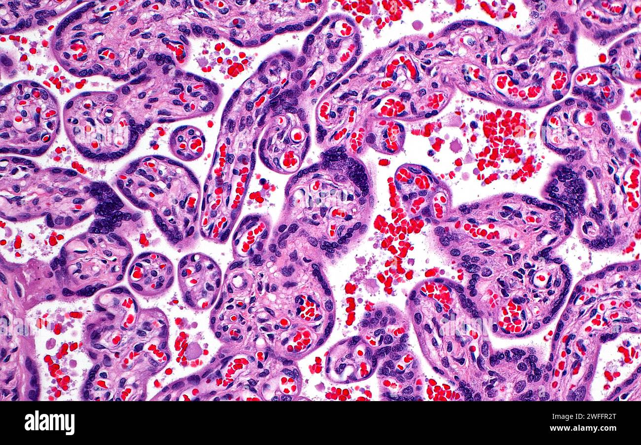 Placenta villi, light micrograph Stock Photo - Alamy