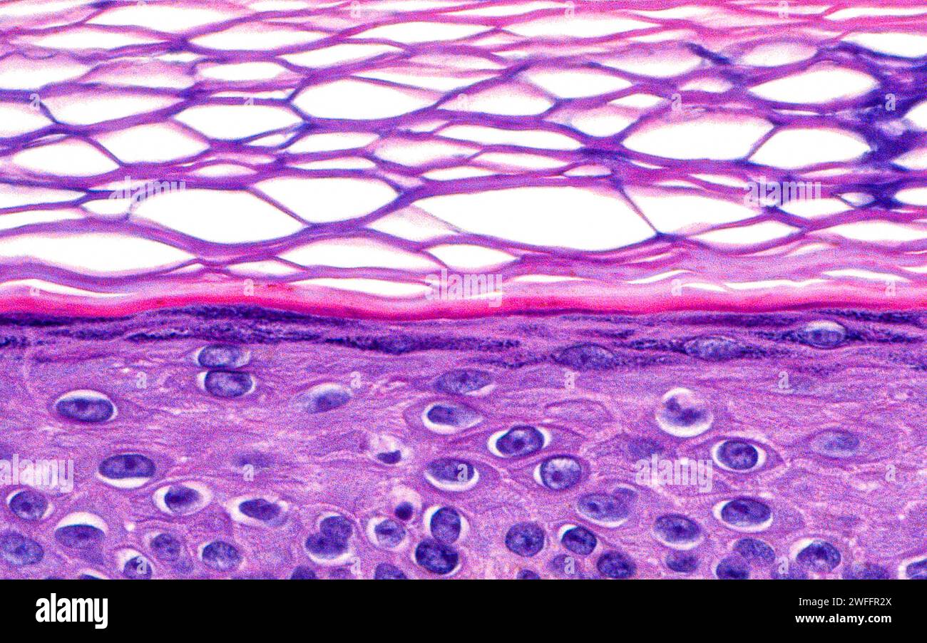 Skin epidermis, light micrograph Stock Photo - Alamy