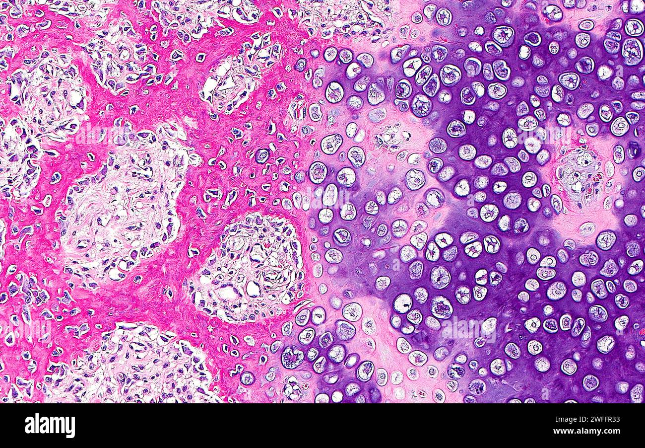 Woven bone and hyaline cartilage, light micrograph Stock Photo - Alamy