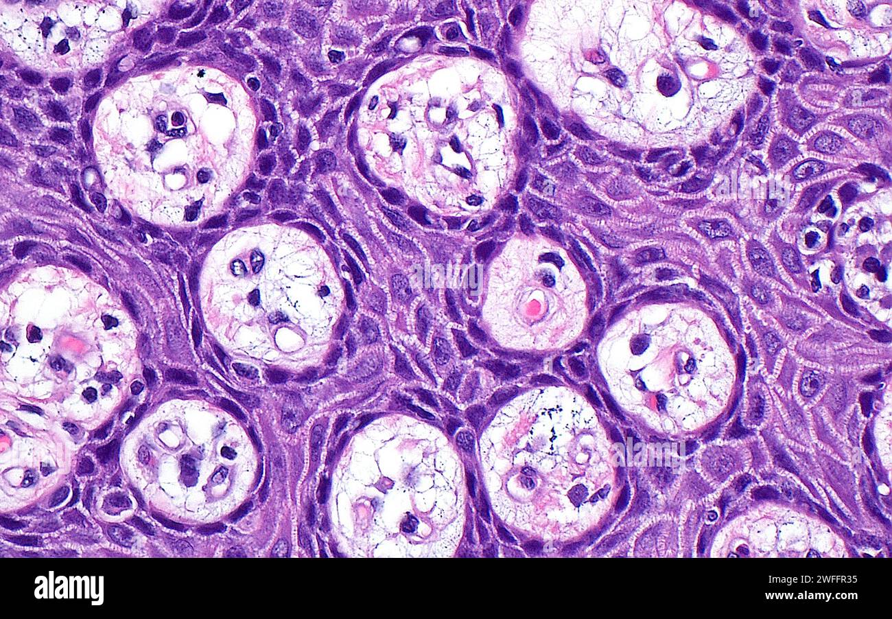 Squamous epithelium, light micrograph Stock Photo - Alamy