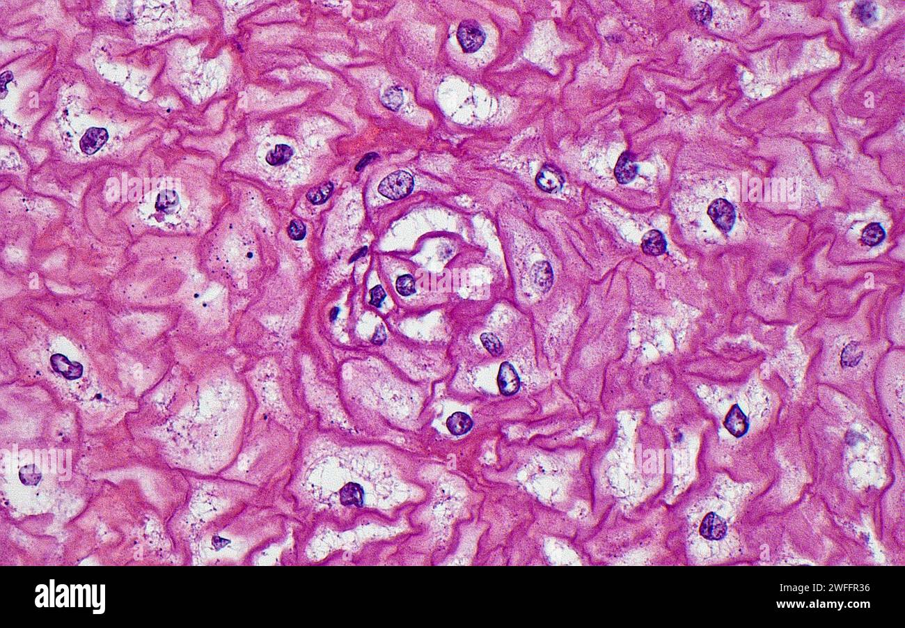 Oesophagus squamous cells, light micrograph Stock Photo - Alamy