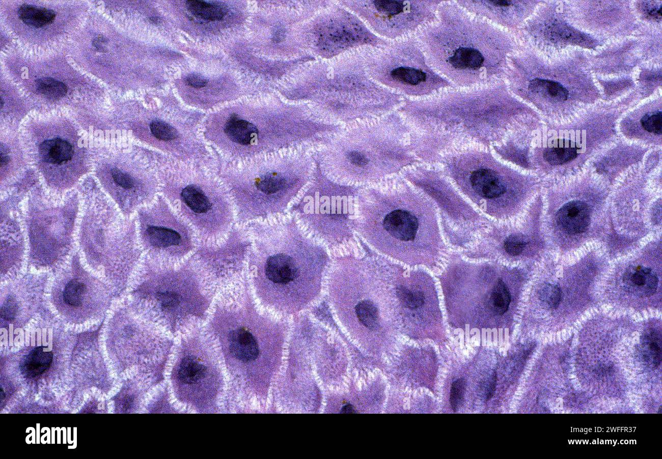 Squamous cells, light micrograph Stock Photo - Alamy