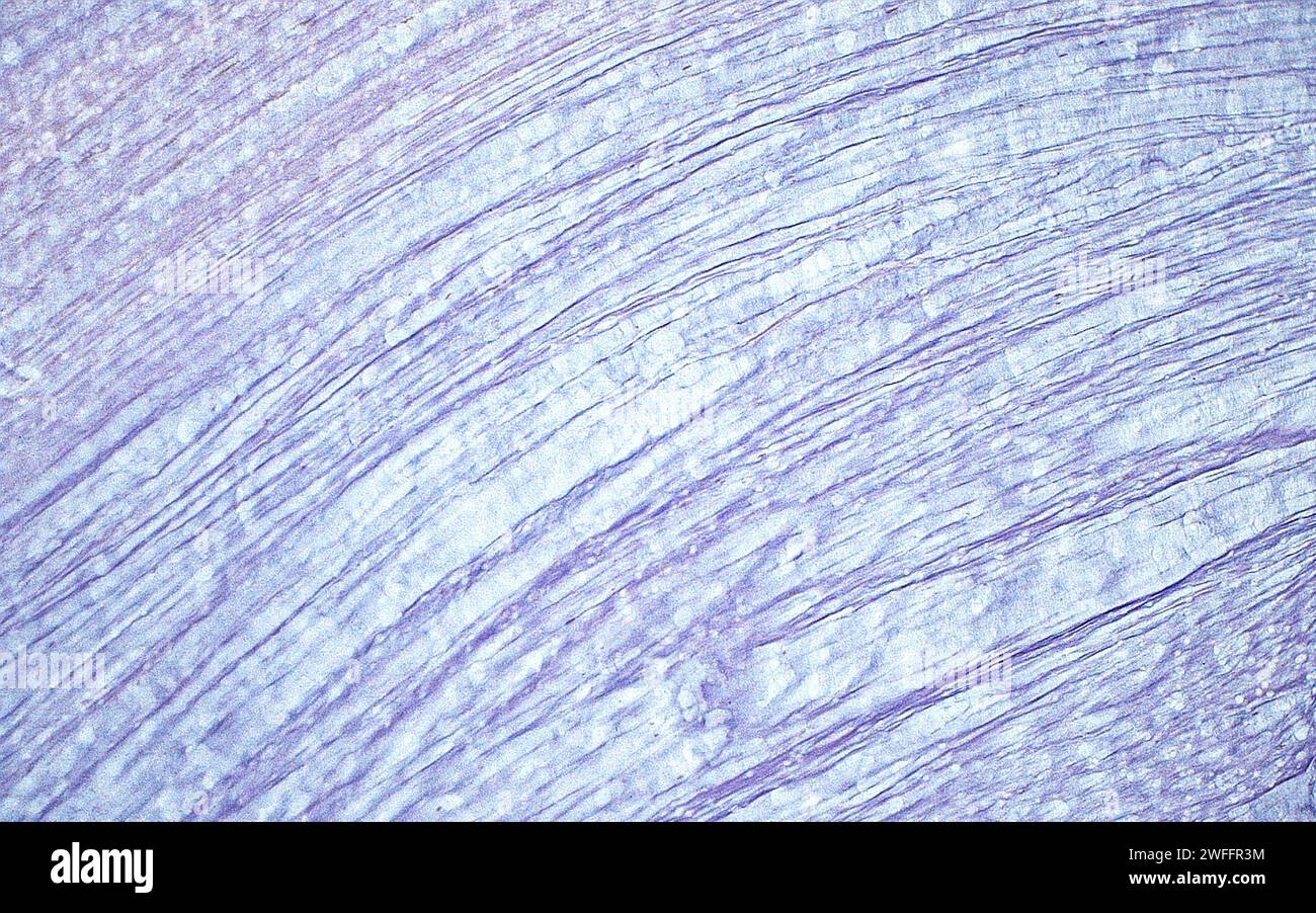 Mucin, light micrograph Stock Photo - Alamy