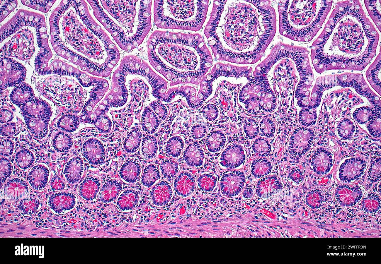 Small bowel Paneth cells, light micrograph Stock Photo - Alamy