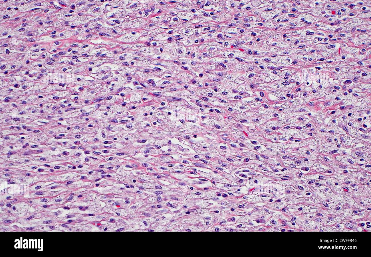 Tissue histiocytes, light micrograph Stock Photo - Alamy