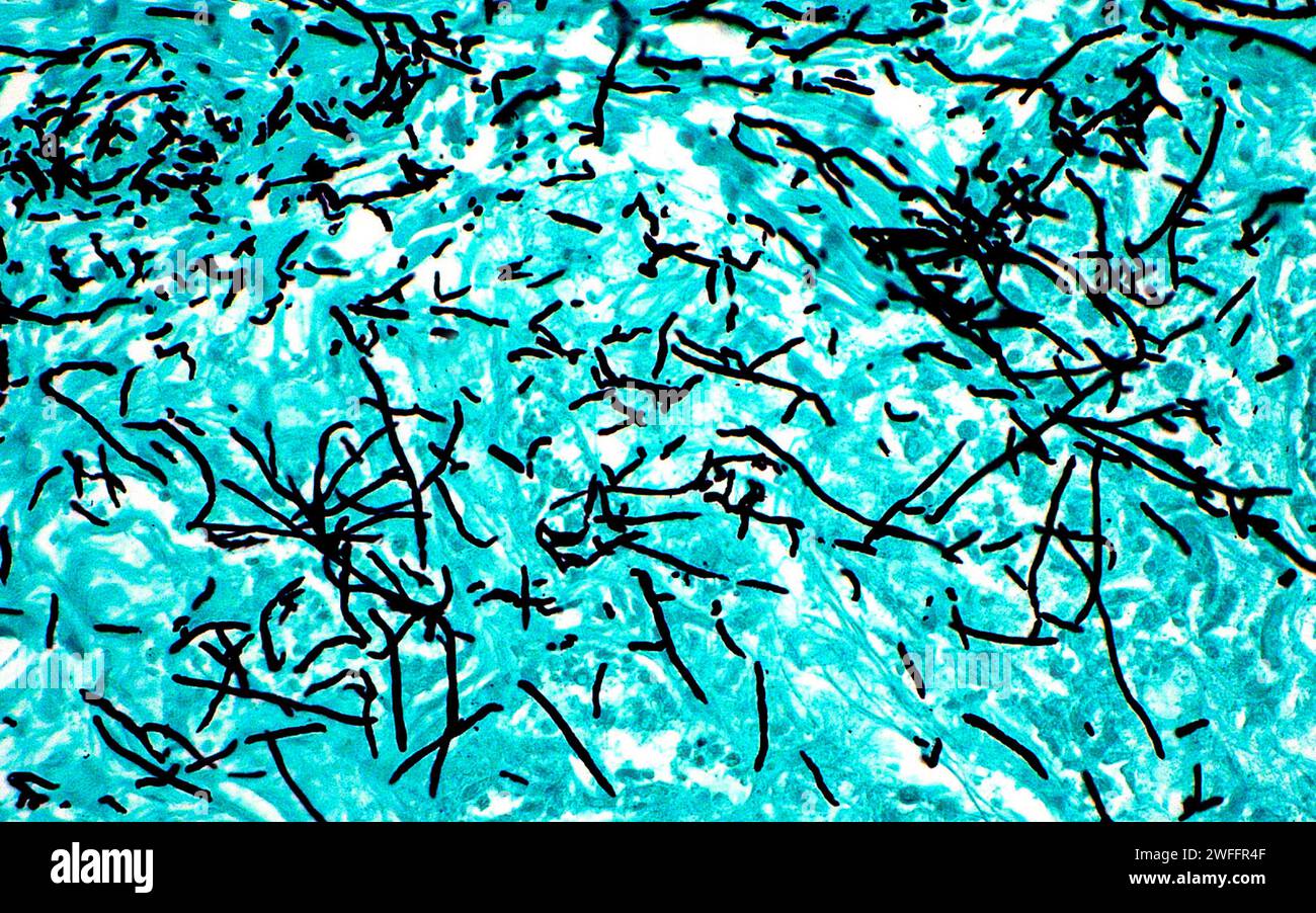 Fungal organism hyphae, light micrograph Stock Photo - Alamy