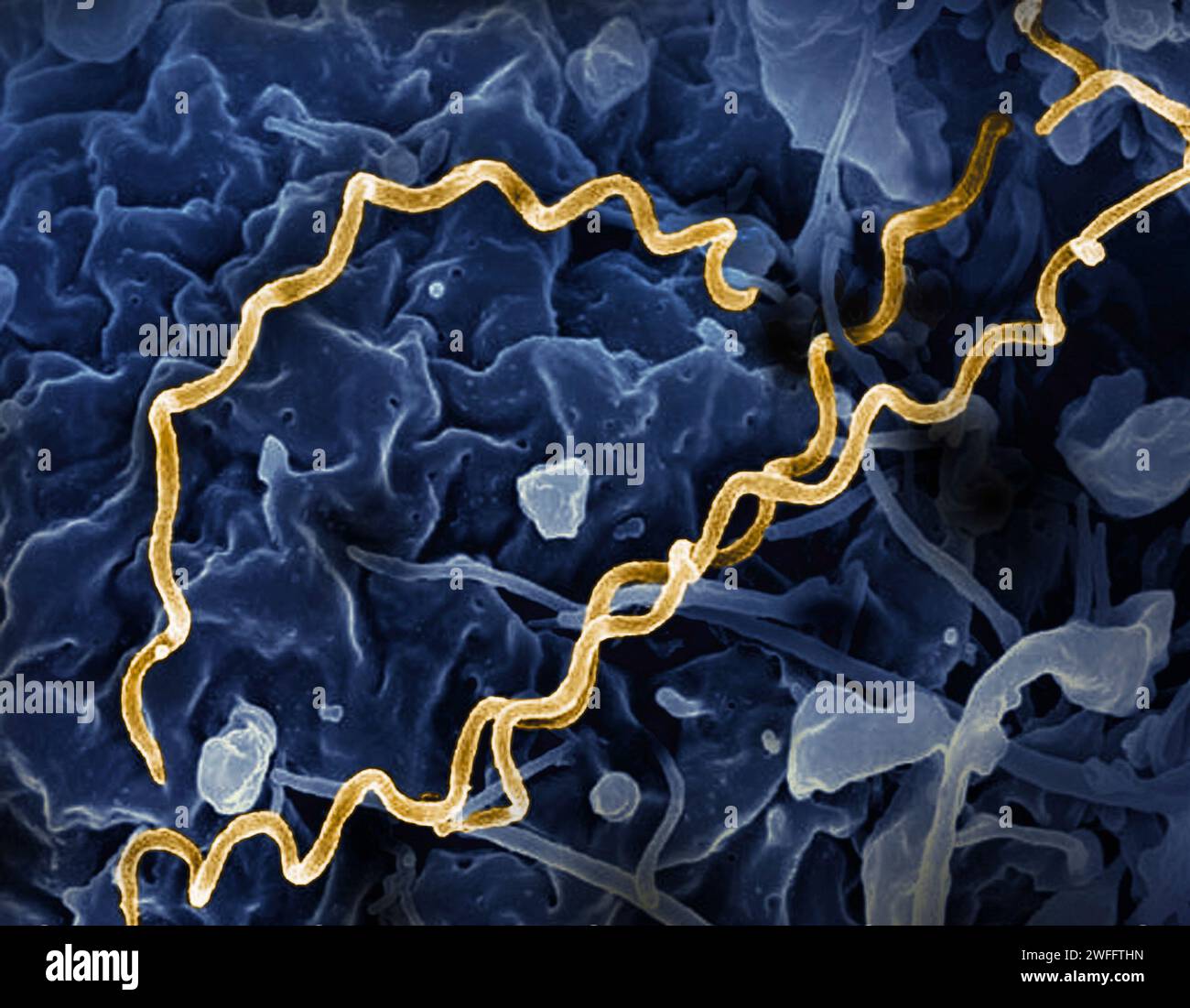 Treponema pallidum syphilis bacteria, SEM Stock Photo - Alamy