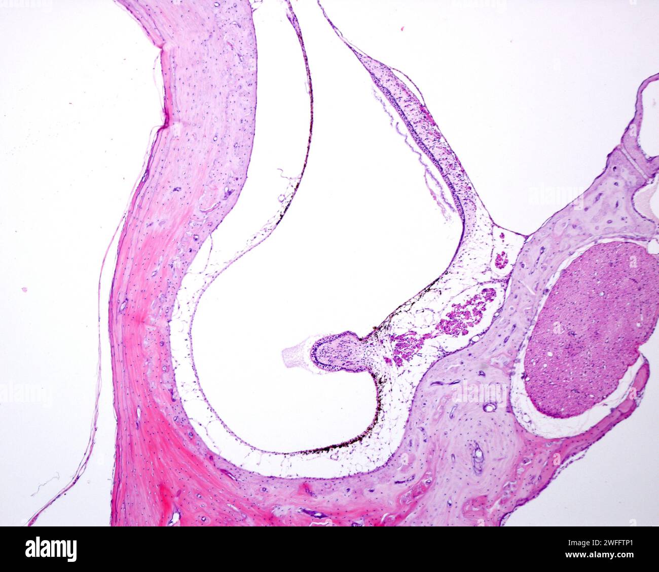 Vestibular system, light micrograph Stock Photo - Alamy