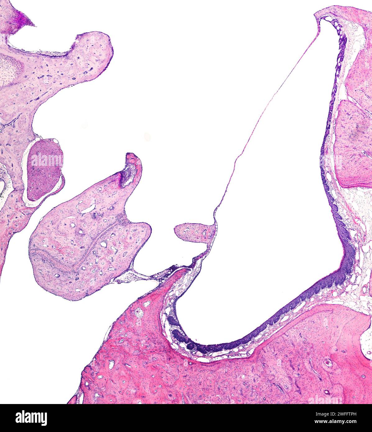 Middle ear, light micrograph Stock Photo - Alamy