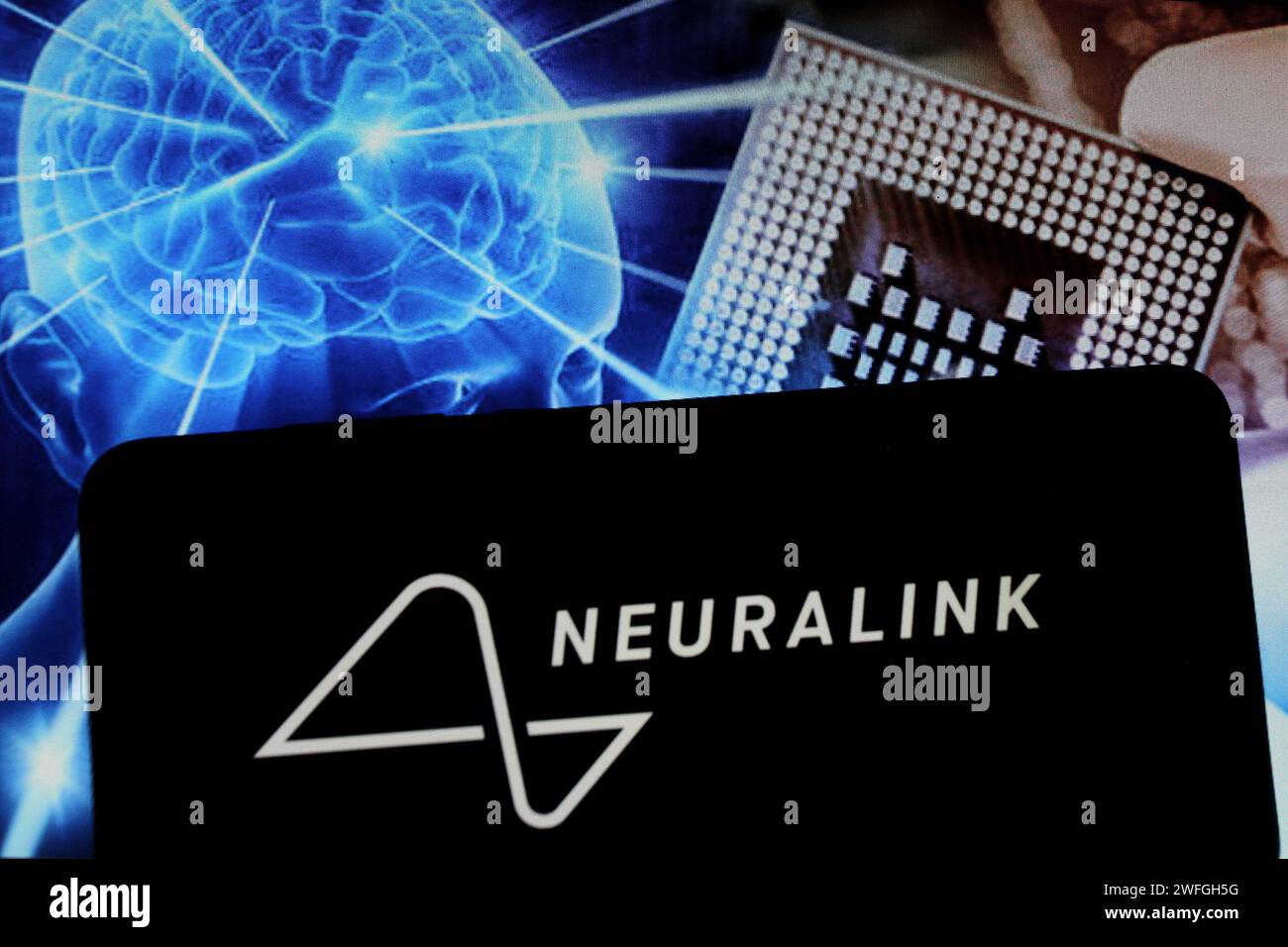 Braincomputer interface hi-res stock photography and images - Alamy