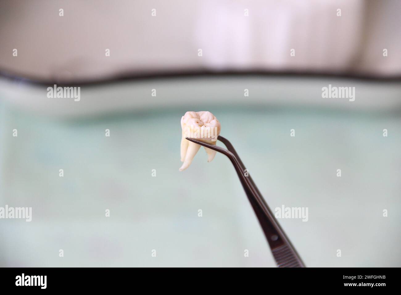 Extracted tooth hi-res stock photography and images - Alamy