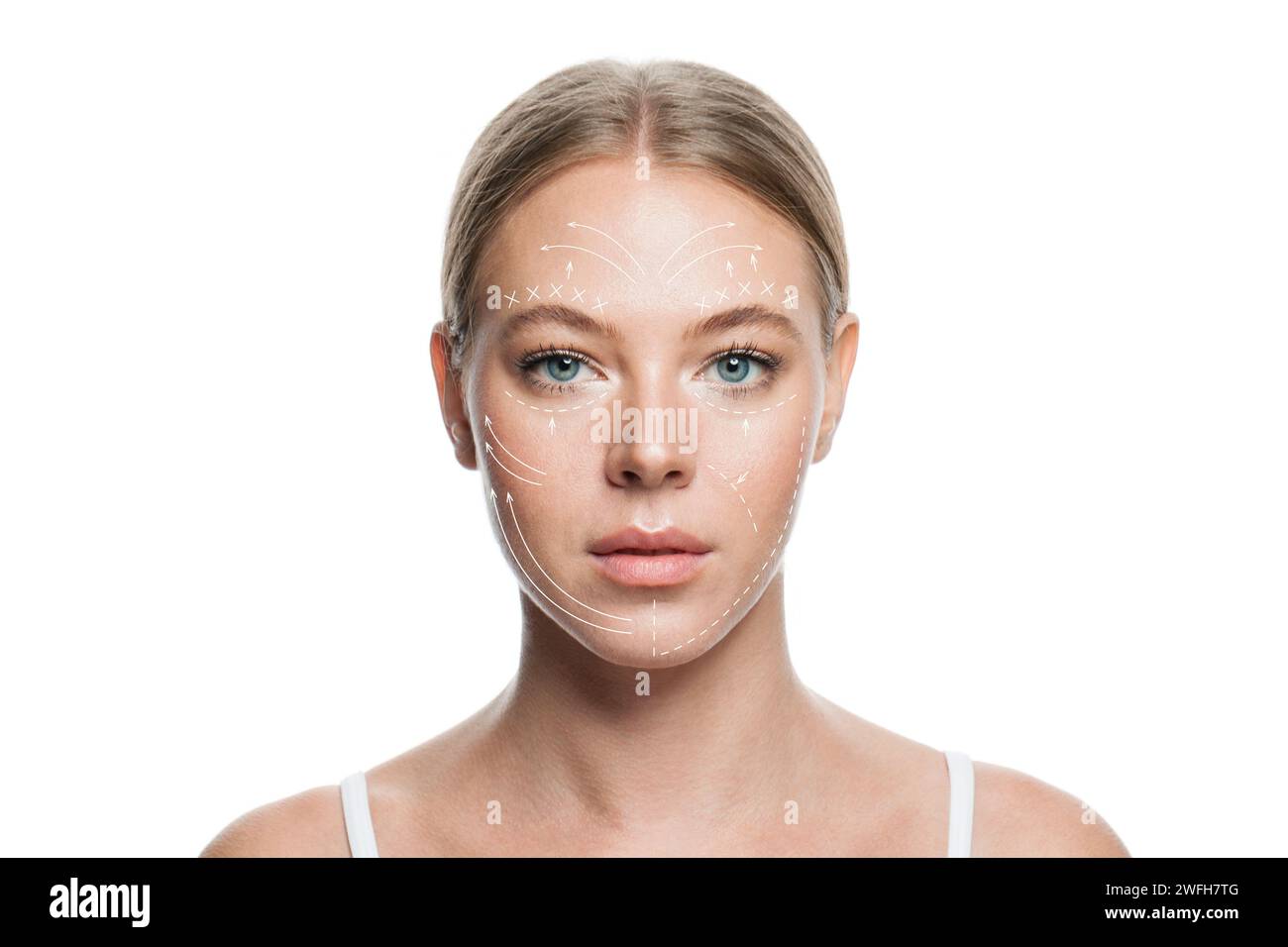 Surgery and Anti Aging Concept. Beautiful blonde woman with white ...
