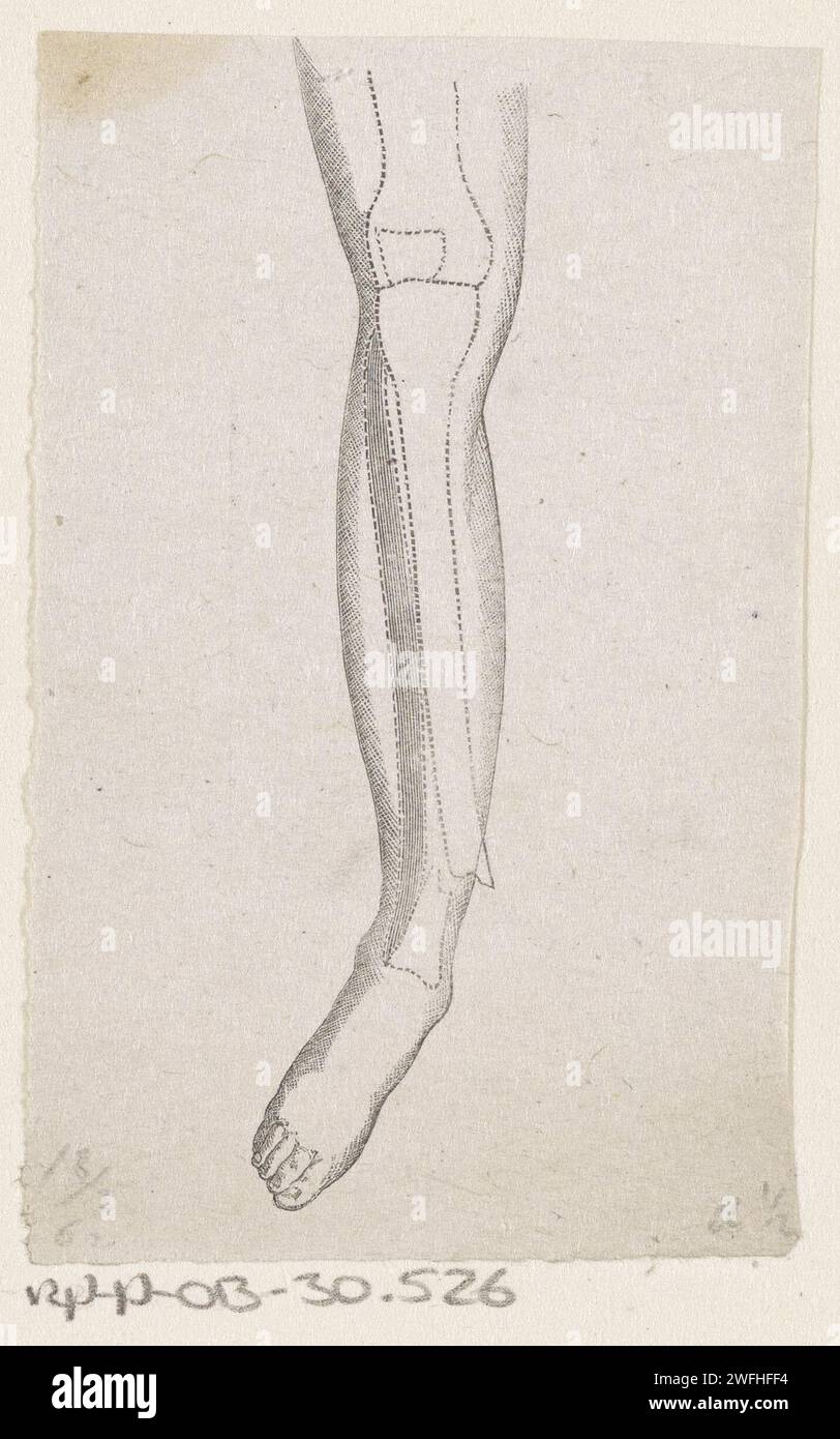 Human Lower leg with a fracture in the bone, Isaac Weissenbruch, 1836 ...