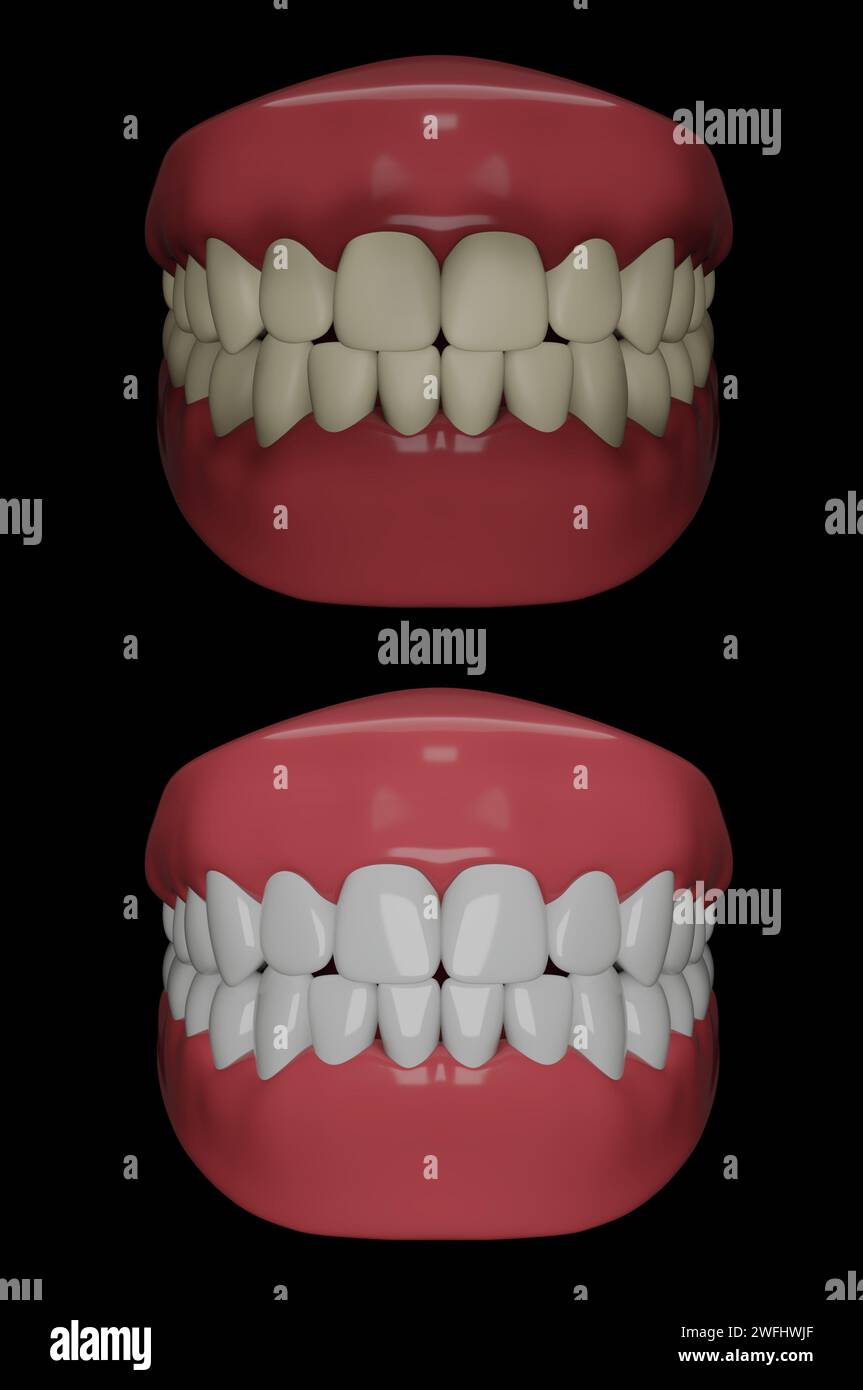 Tooth visualization hi-res stock photography and images - Alamy