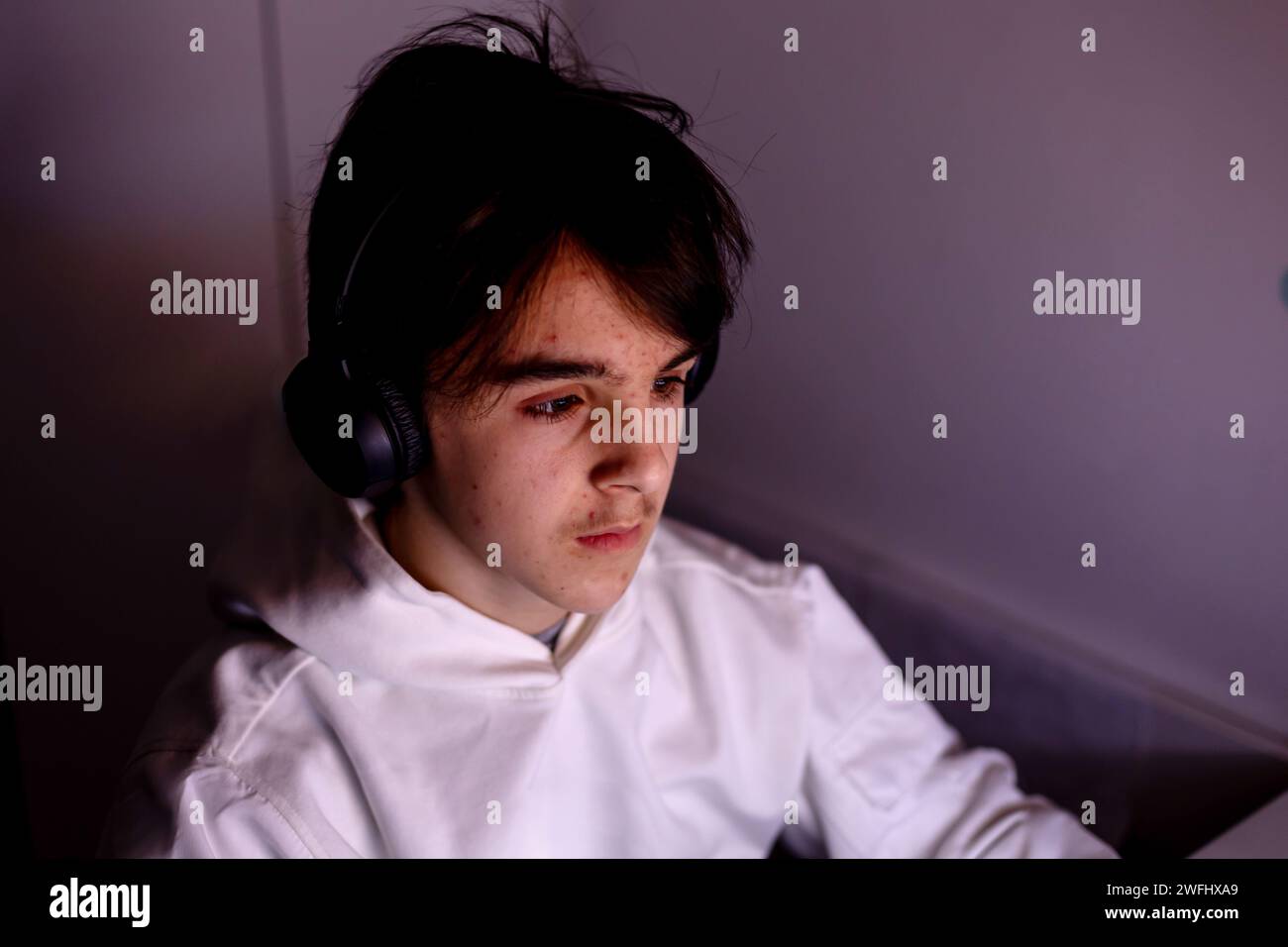 Preteen boy with heavy acne, red pimples, playing on computer at home ...